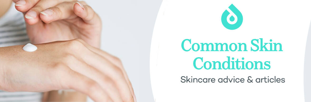 Common Skin Conditions And How To Treat Them | Dermacare | Dermacare