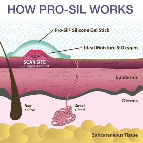 Pro-Sil glide-on Silicone Scar Stick 4.25g