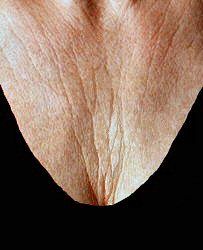 7 Ways to Get Rid of Chest Wrinkles | Dermacare